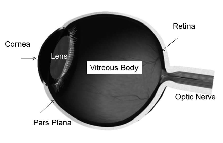 Development of Surgical Treatment for Vitreous Disease