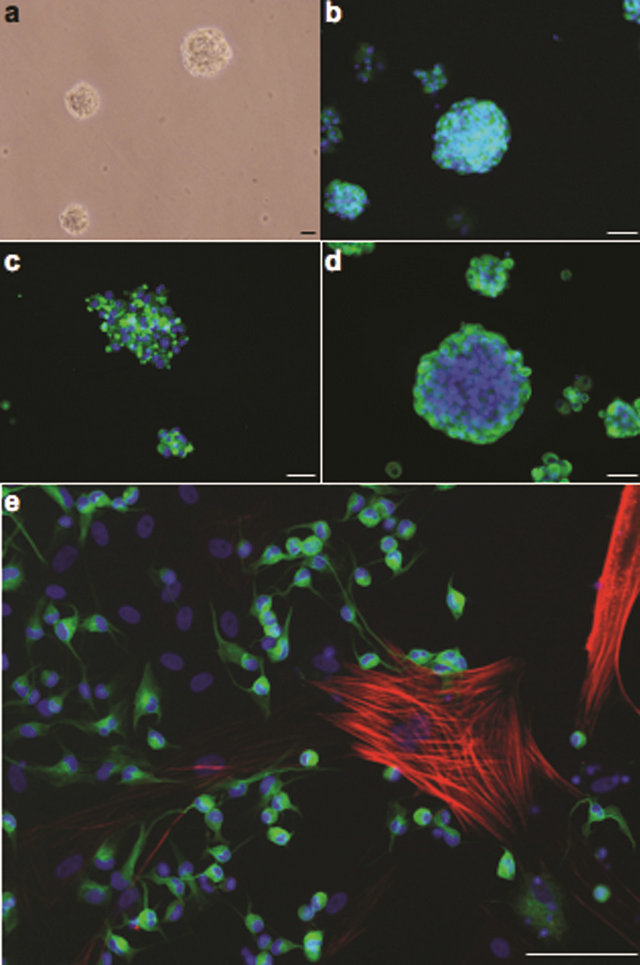 Optimization of the porcine adult skin-derived precursor cell isolation ...