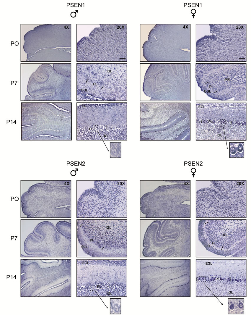 Sex Effect On Presenilins Expression In Post Natal Rat Brain