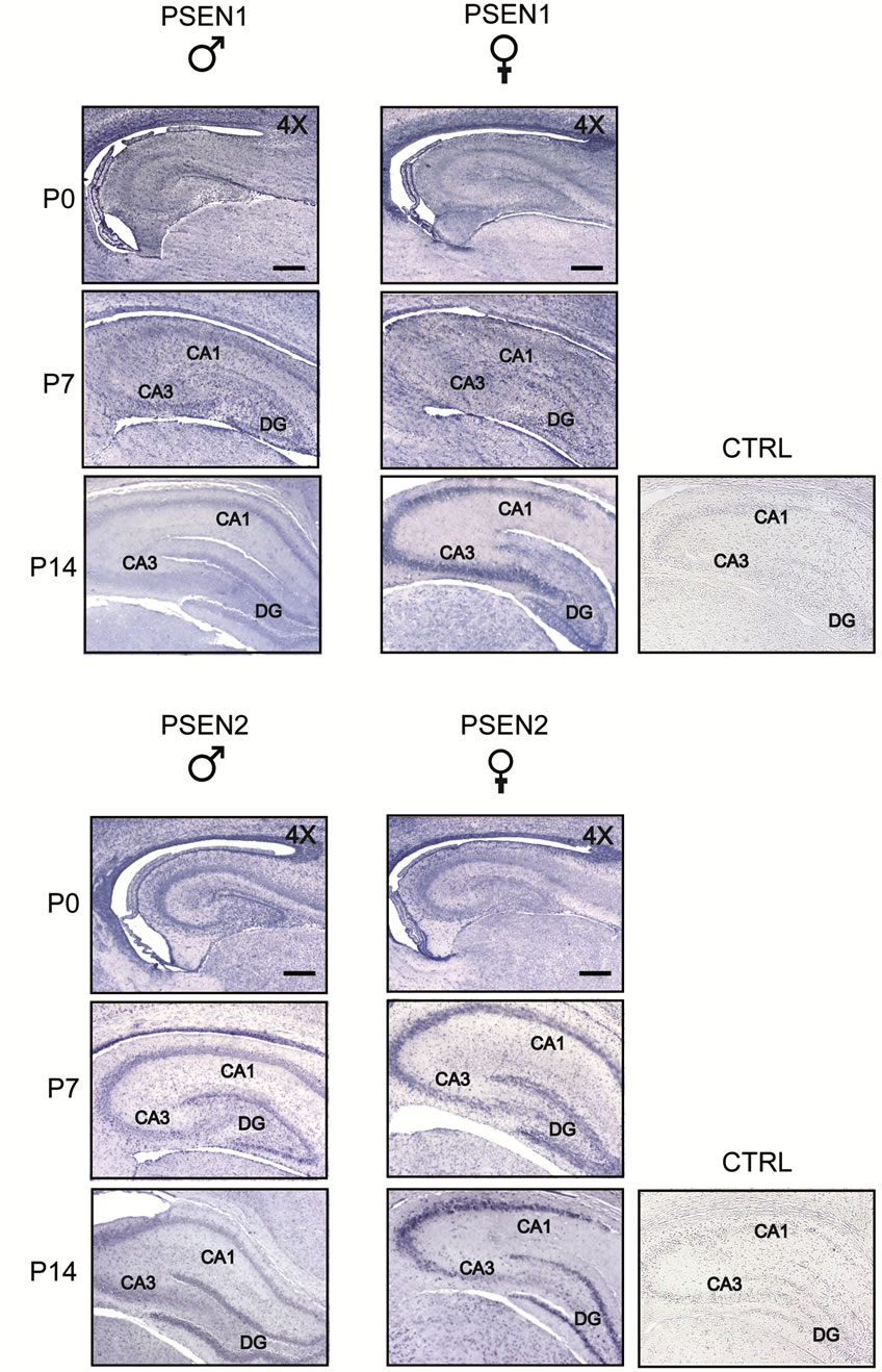 Sex Effect On Presenilins Expression In Post Natal Rat Brain