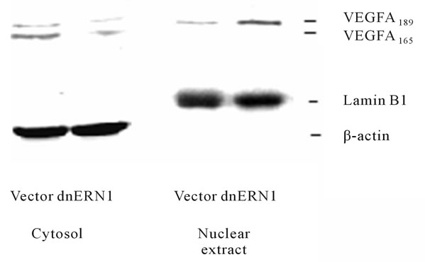 The vascular endothelial growth factor genes expression in glioma U87 ...