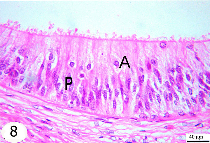 Morphological Studies on the Epididymal Duct of the One-Humped Camel ...