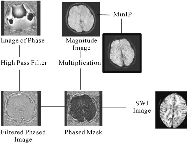The influence of the blood pressure on the venous cerebral flow ...