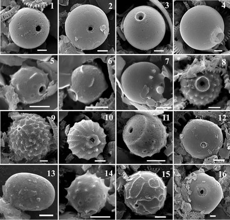 Chrysophycean Stomatocysts in the Upper Pleistocene and Holocene ...
