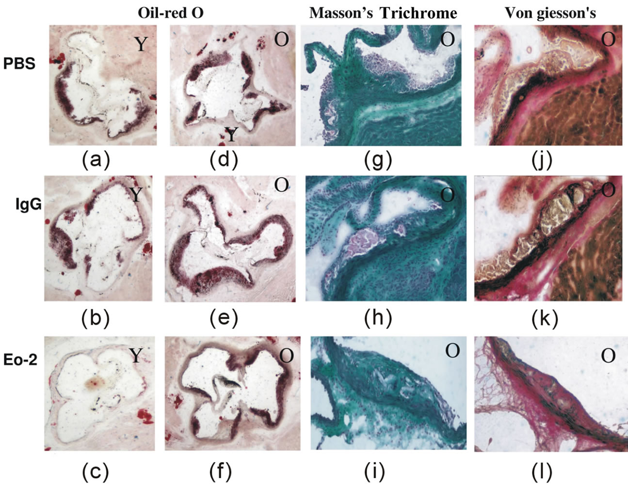 Anti eotaxin-2 antibodies attenuate the initiation and progression of ...