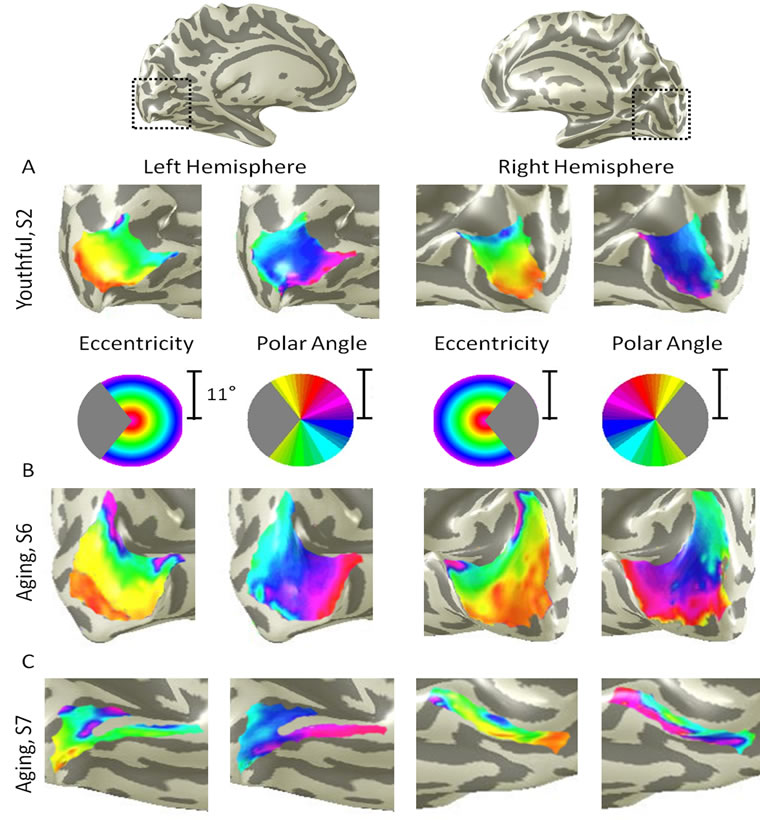 Effects of healthy aging on human primary visual cortex