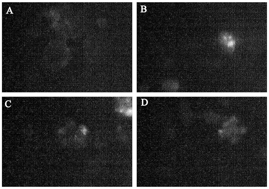 Changes in the Nuclei of Infected Cells at Early Stages of Infection ...