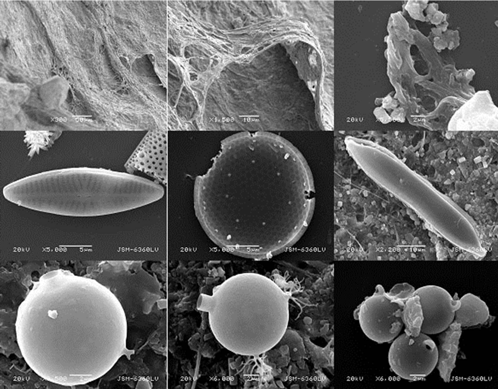 Distribution of Siliceous-Walled Algae in Taylor Valley, Antarctica Lakes
