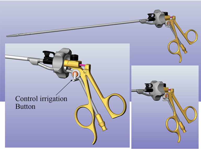 The new Surgical Instrument in Peritoneal Endometriosis Resection