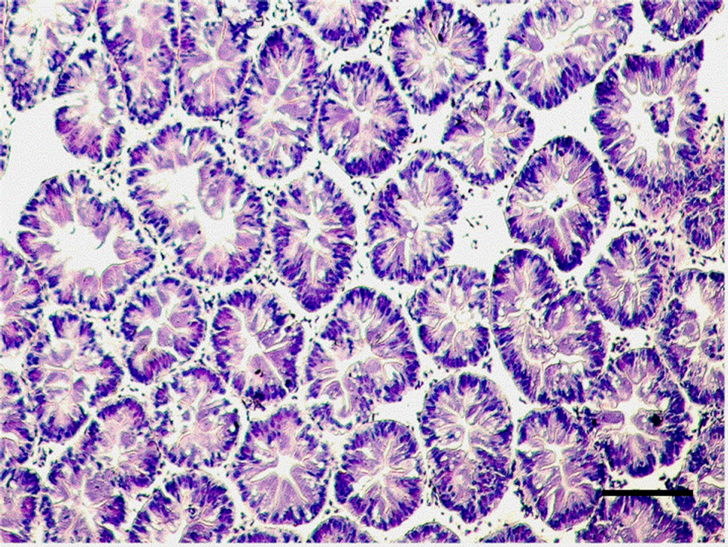 Sublethal Antimony (III) Exposure of Freshwater Swamp Shrimp ...