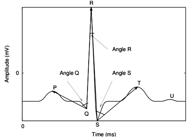 Evaluation of Electrocardiogram for Biometric Authentication