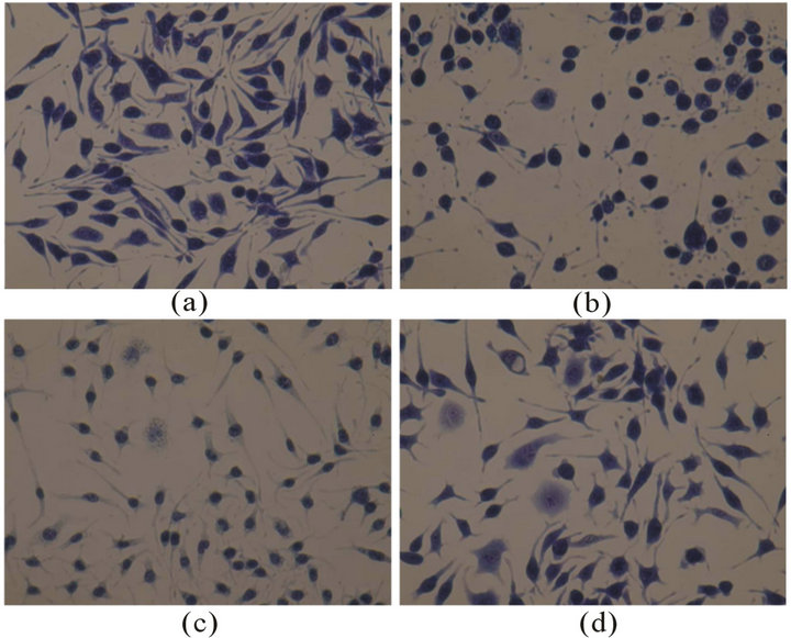 Studies on the Degranulation of RBL-2H3 Cells Induced by Traditional Chinese Medicine Injections