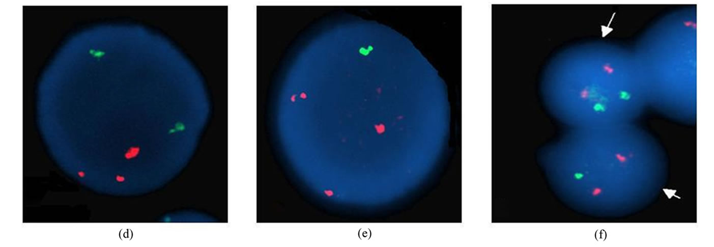 Applications of Fluorescence in Situ Hybridization (FISH) for Detecting ...