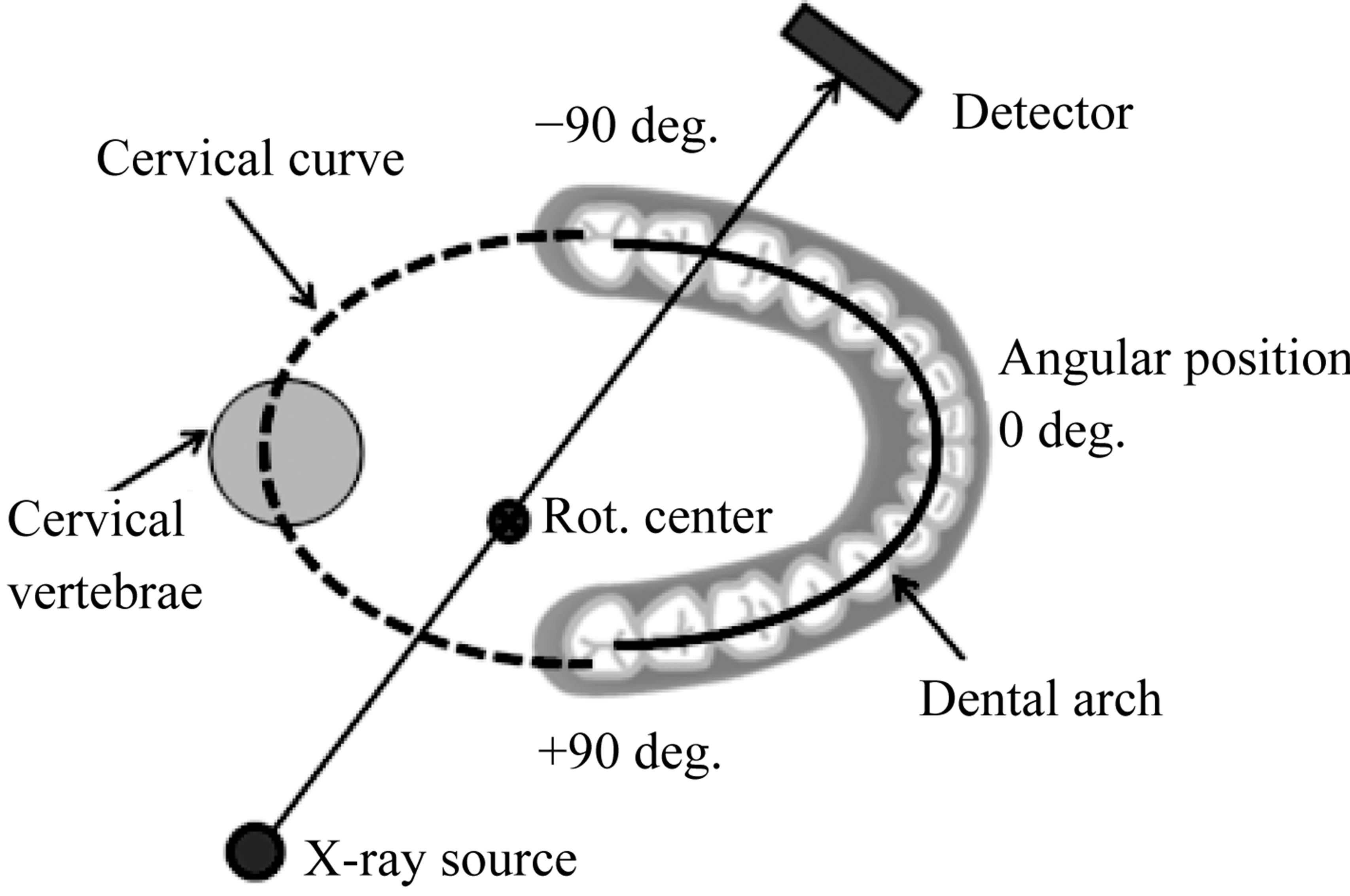 Removal of the Shadow of Cervical Vertebrae from Panoramic X-Ray Images with a Tomosynthesis Method