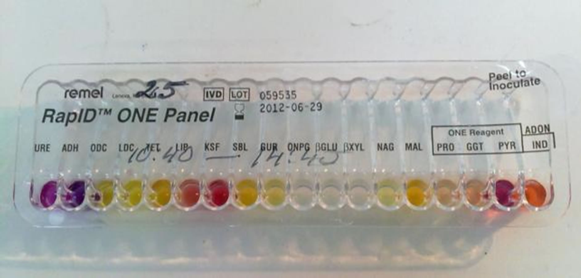 Non-Fermentative Gram-Negative Bacteria in Drinking Water