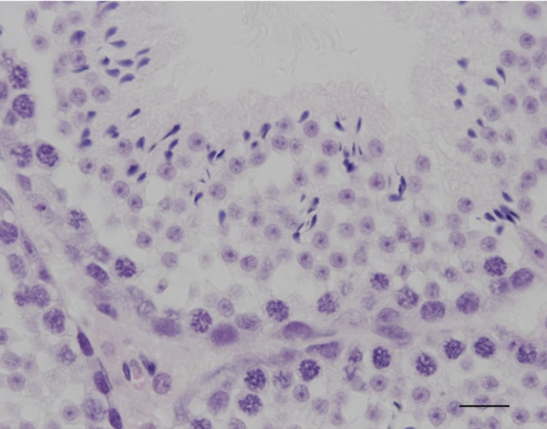 Pronuclear microinjection is not suitable for RNA polymerase III ...