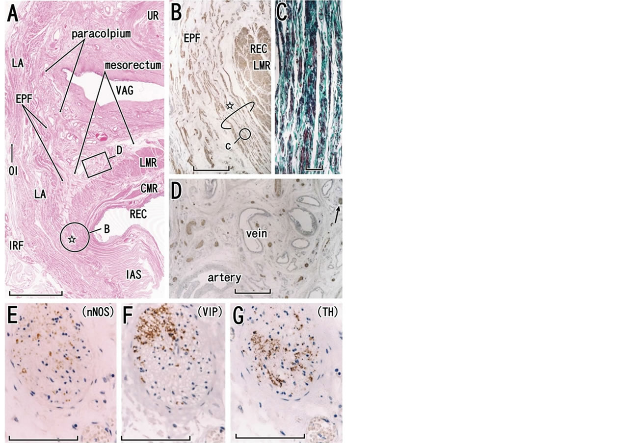 Supportive tissues of the vagina with special reference to a fibrous ...