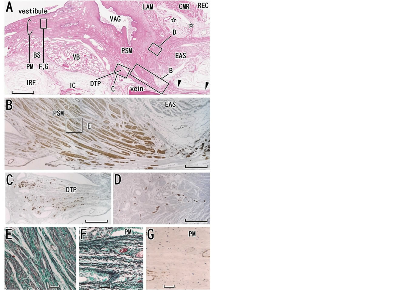Supportive tissues of the vagina with special reference to a fibrous ...