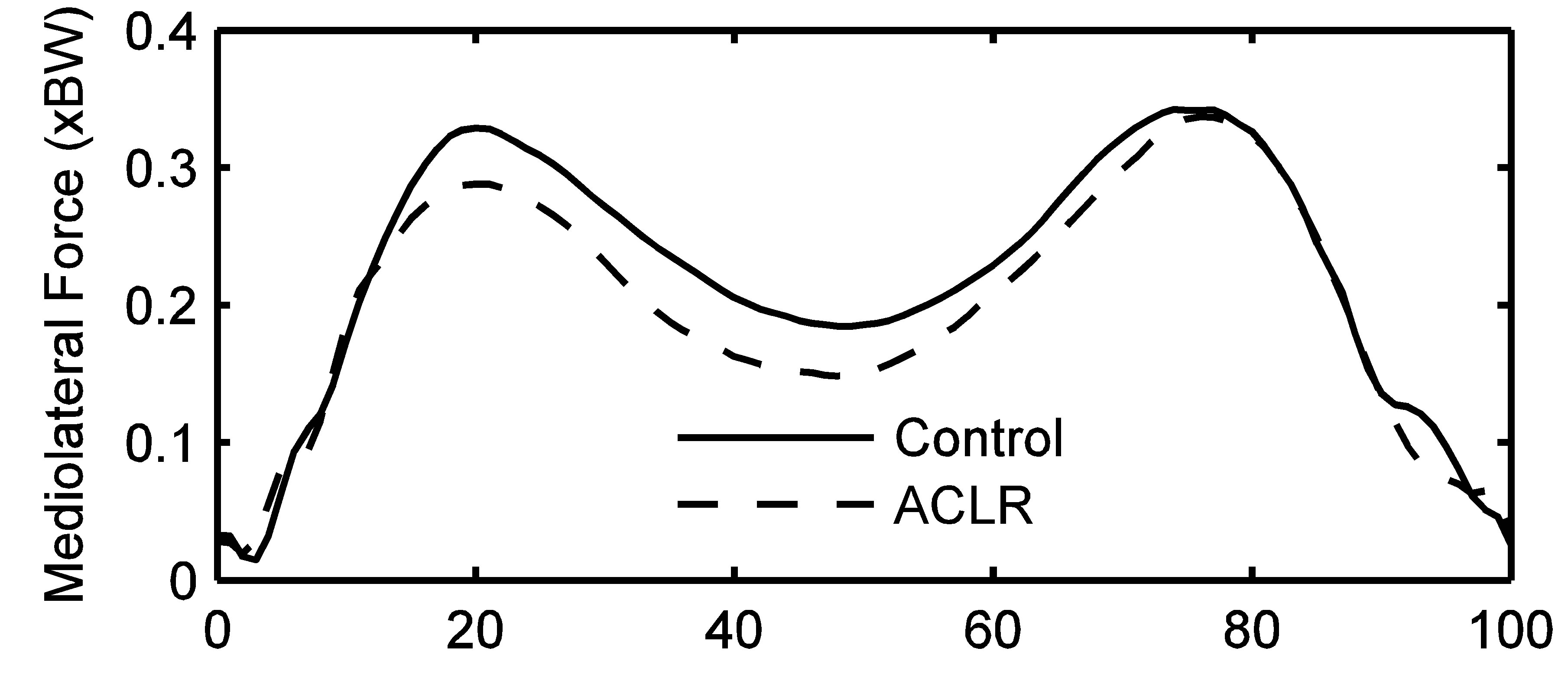 Tibiofemoral Joint Forces during the Stance Phase of Gait after ACL ...