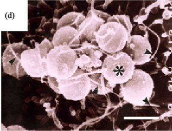 Coccoid Helicobacter pylori Can Directly Adhere and Invade in Agminated ...