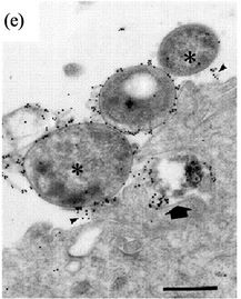 Coccoid Helicobacter pylori Can Directly Adhere and Invade in Agminated ...