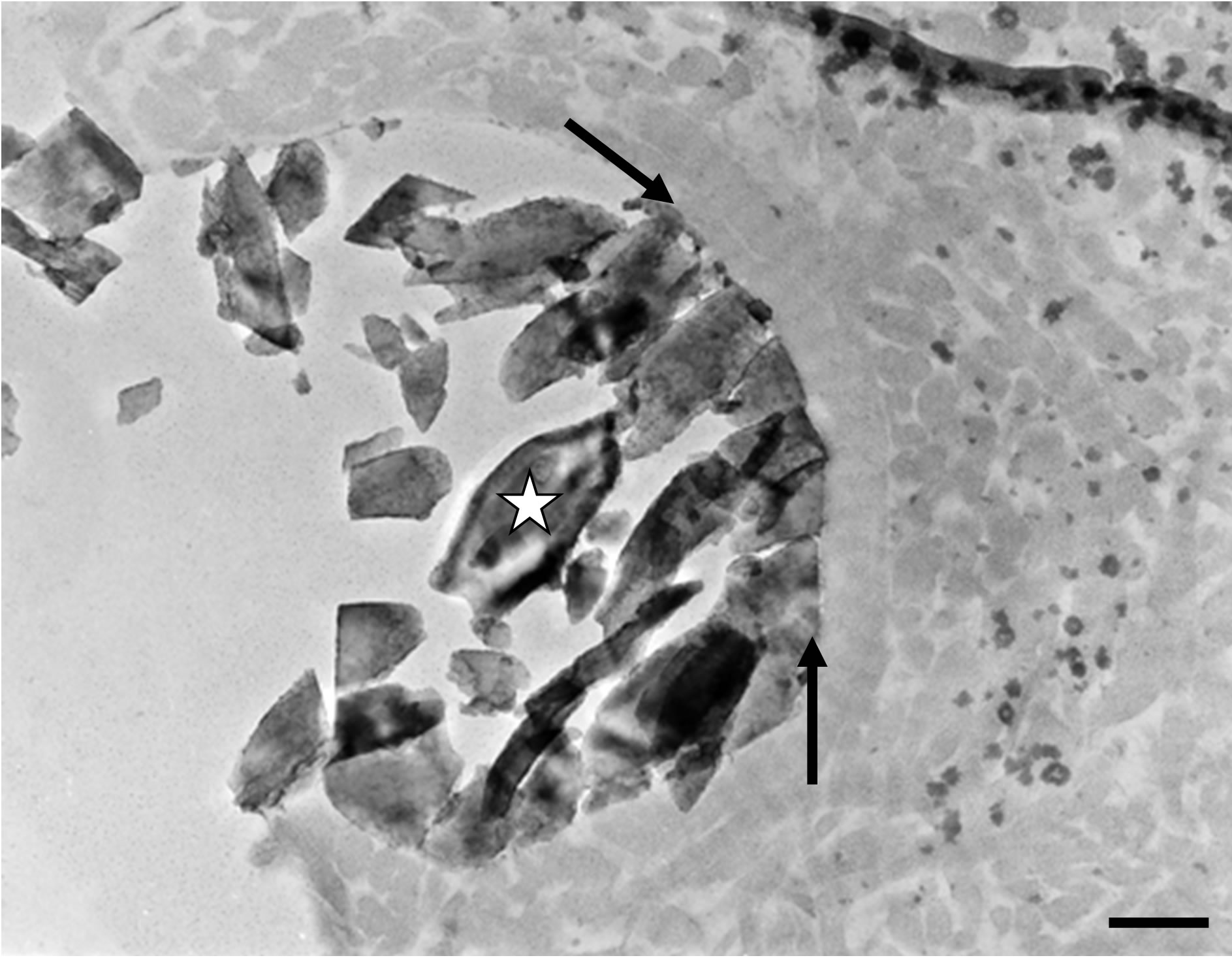 Ultrastructure and Analytical Features of the Sinus Floor Augmentation ...