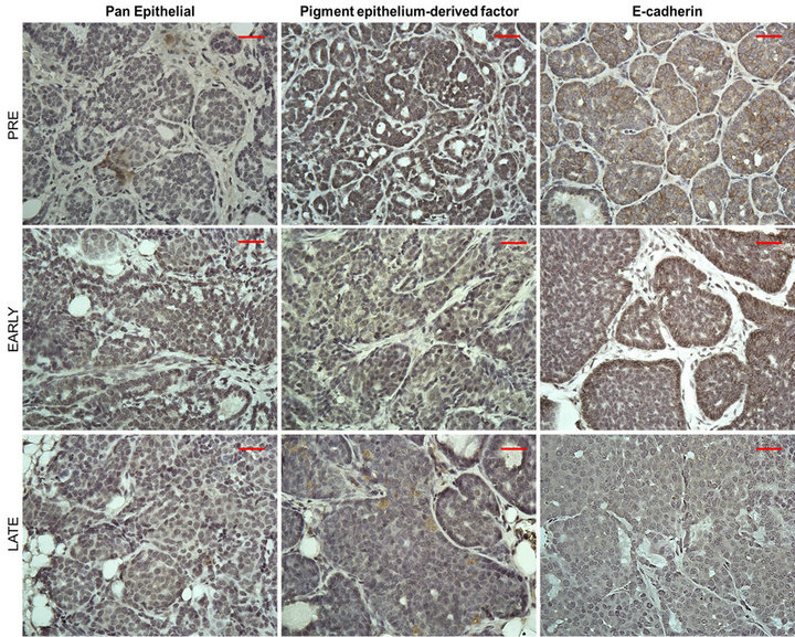 The MMTV-PyVT Transgenic Mouse as a Multistage Model for Mammary ...