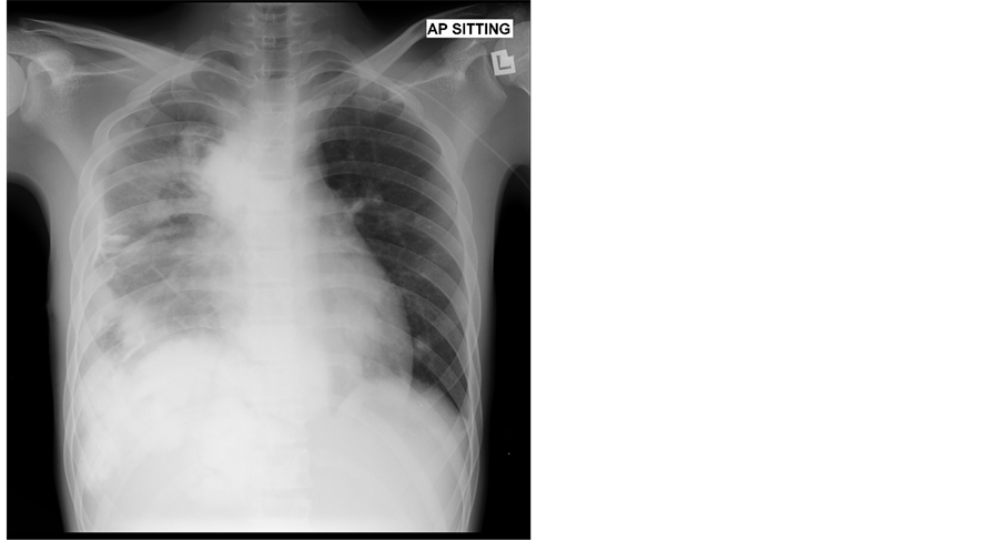 Single Photon Emission Computed Tomography-Computed Tomography (SPECT ...