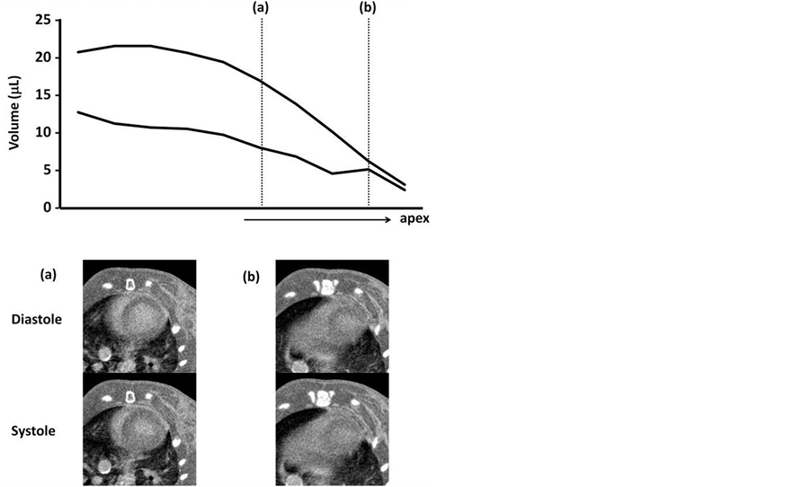 Micro-Computed Tomography Provides Accurate Measurement for Cardiac ...