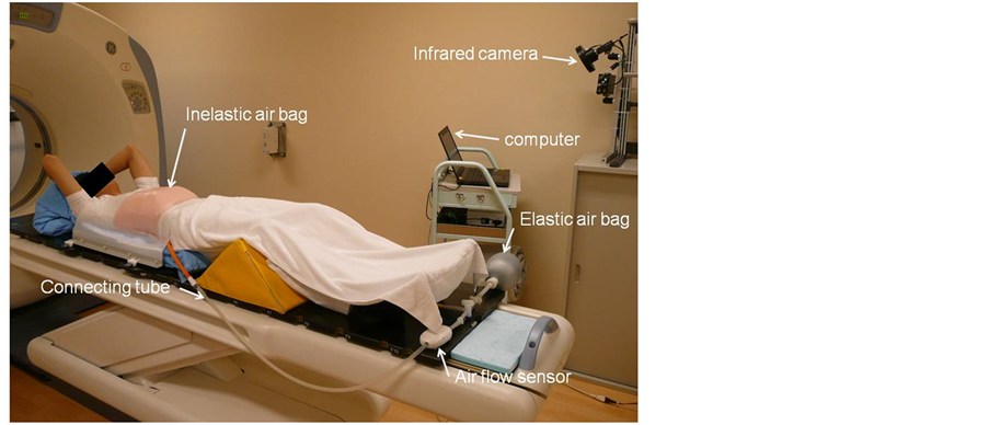 Lung Stereotactic Body Radiotherapy Using an Abdominal Compression ...