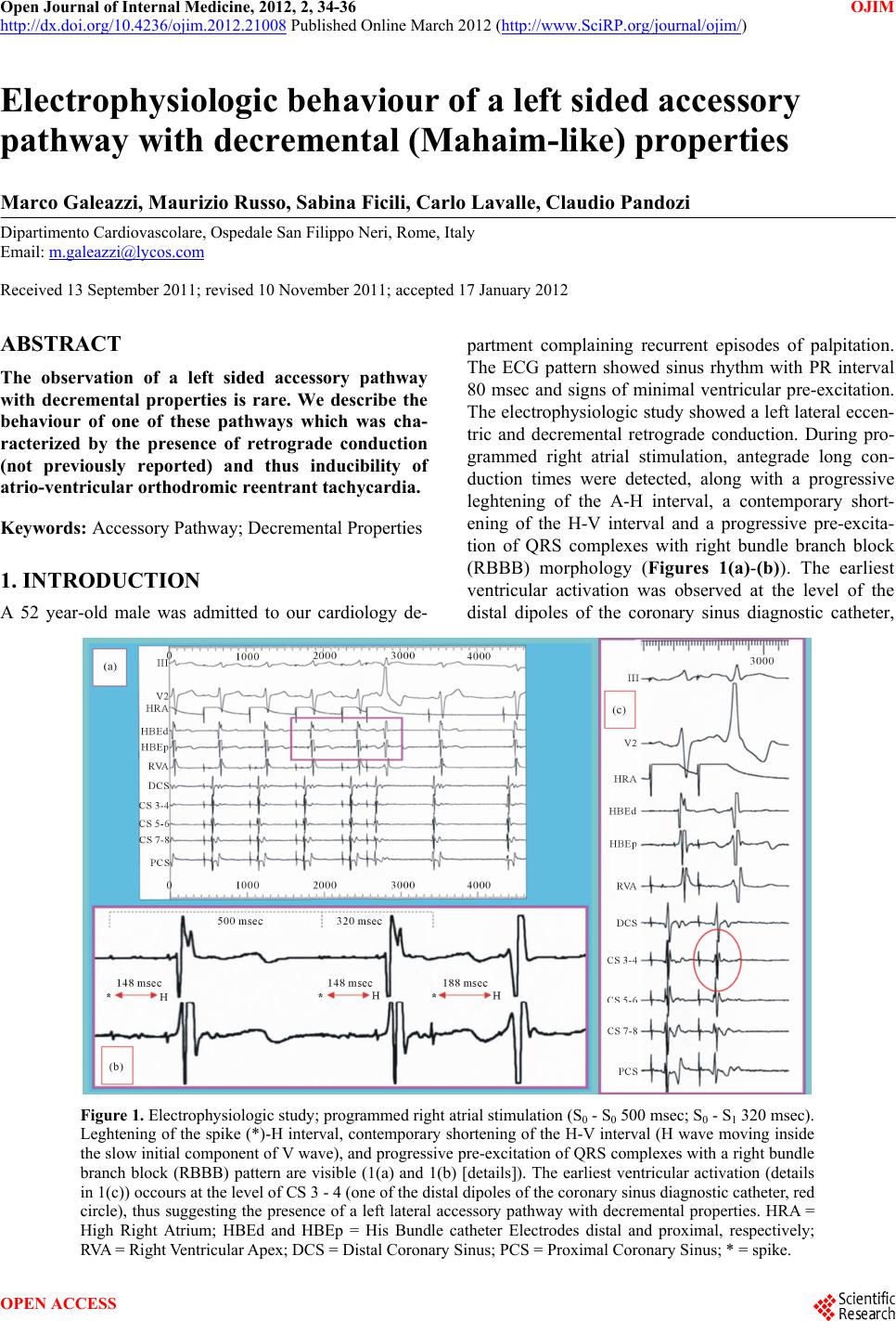 Electrophysiologic behaviour of a left sided accessory pathway with ...