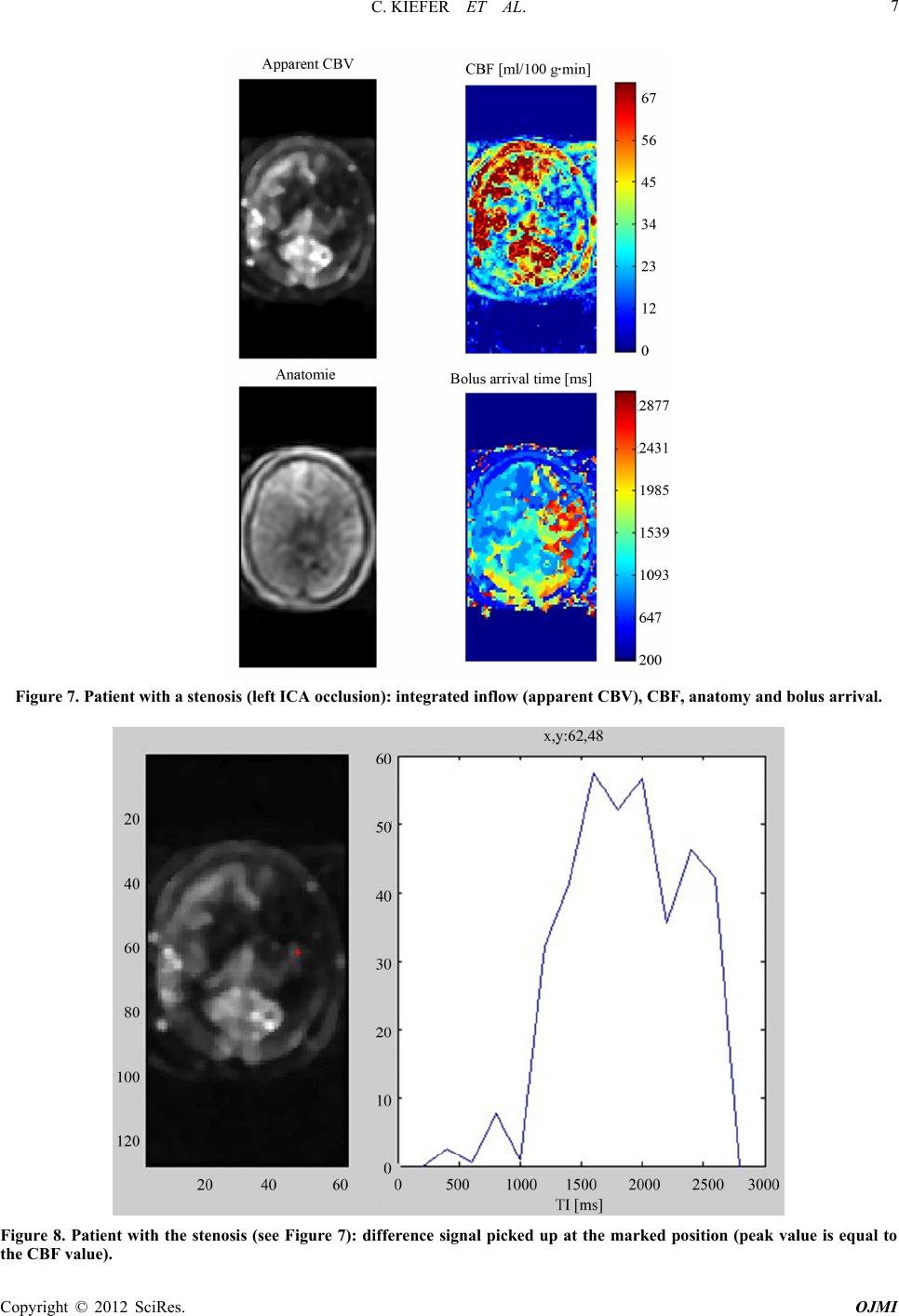 Qualitative and Quantitative Perfusion Parameters Determined by 3D ...