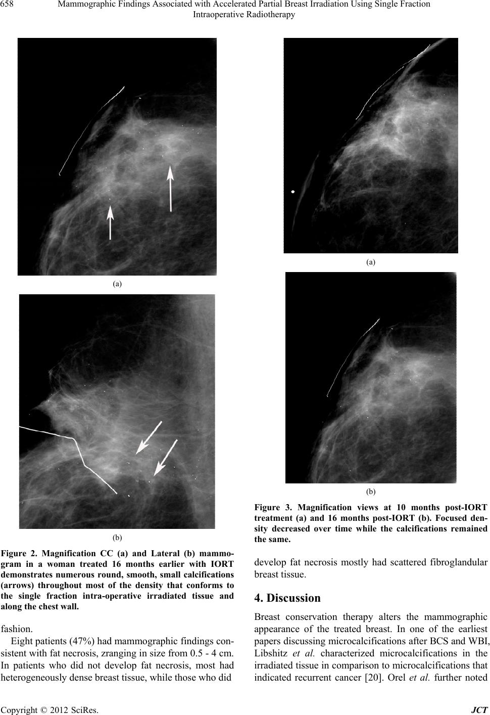 Mammographic Findings Associated with Accelerated Partial Breast ...