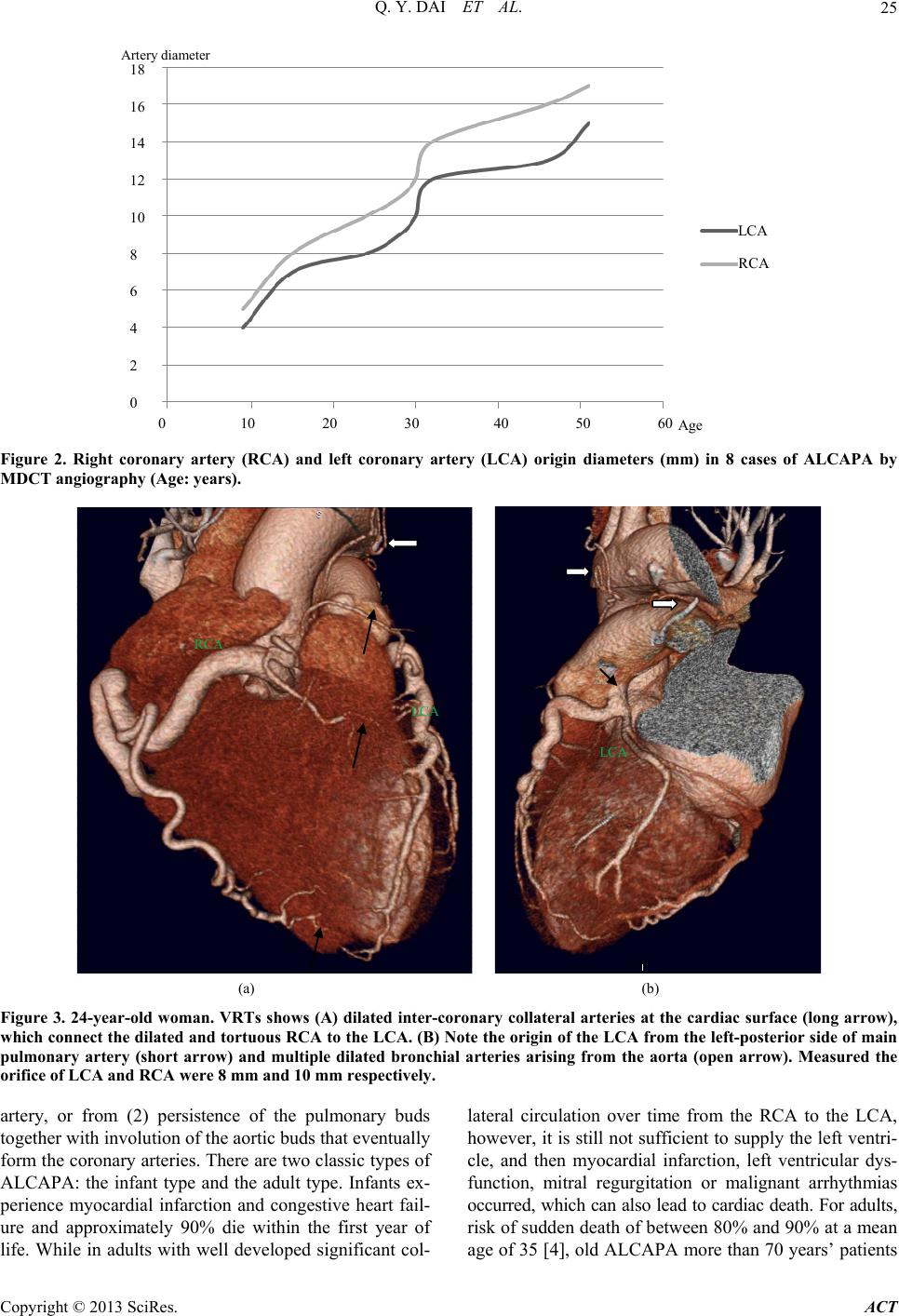 MDCT Angiography Imaging Presentation of ALCAPA in Adults