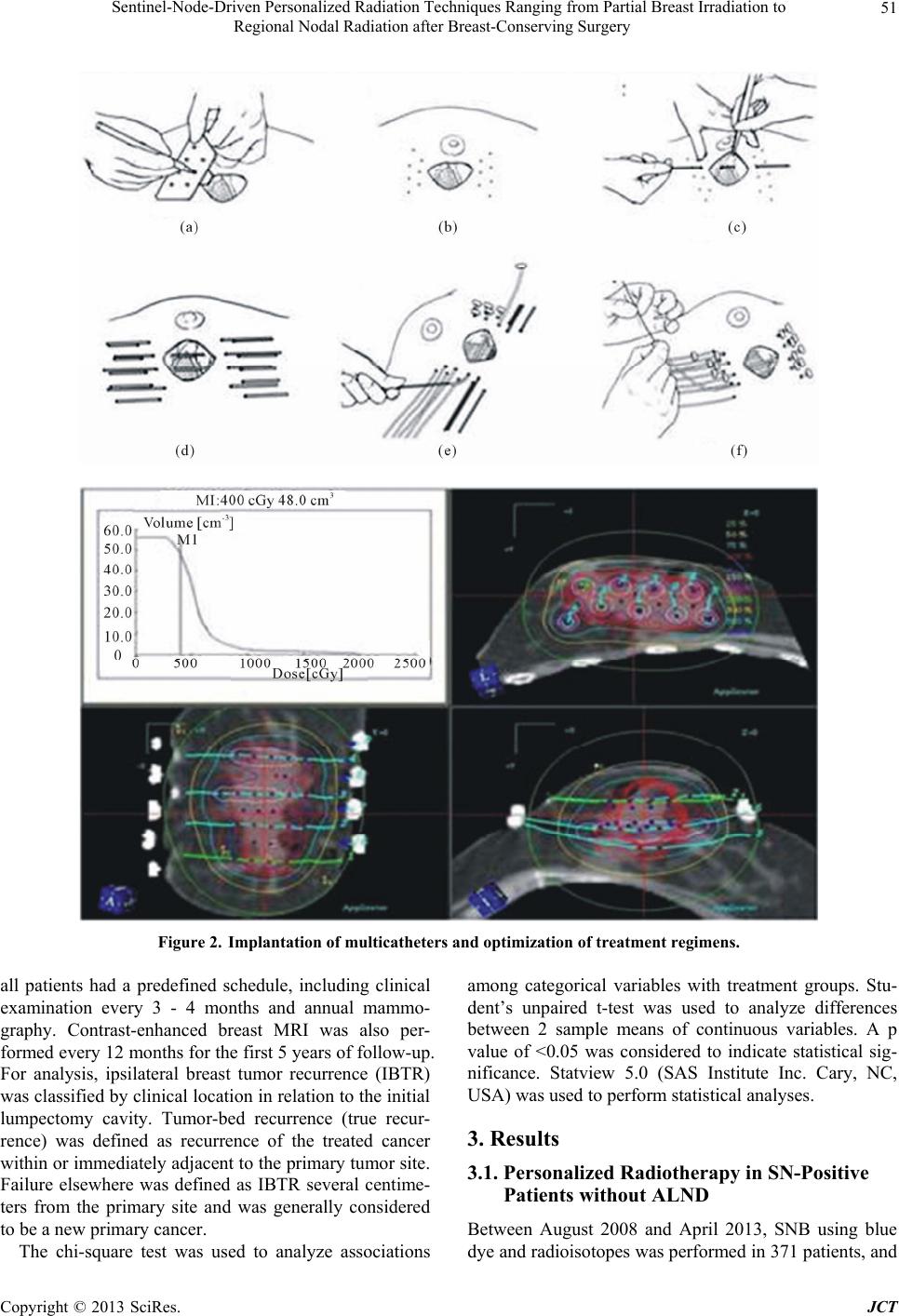 Sentinel-Node-Driven Personalized Radiation Techniques Ranging from ...