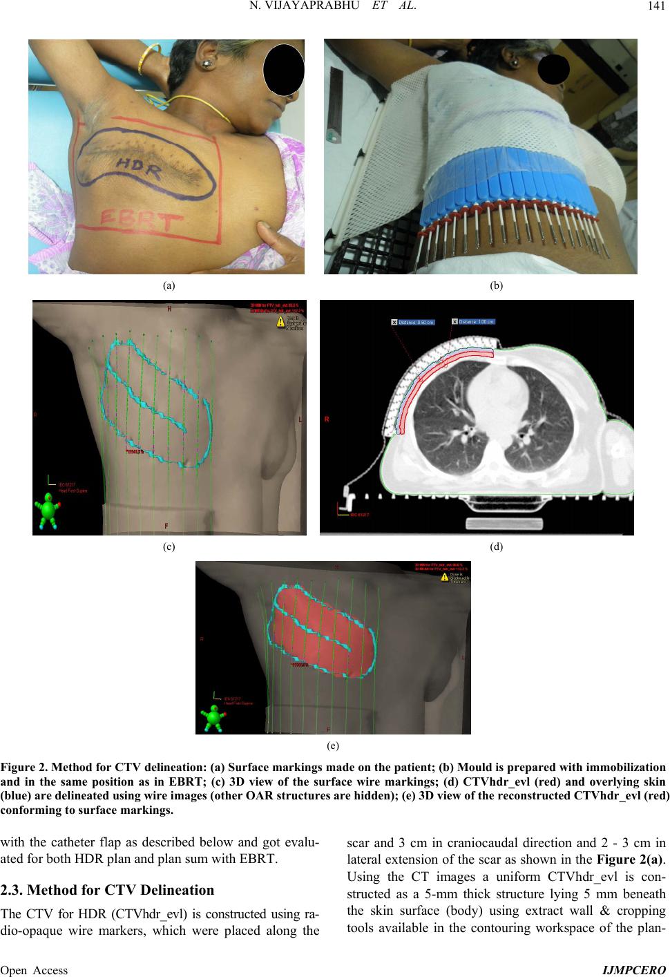 Postmastectomy Scar Boost Irradiation Using HDR Surface Mould ...
