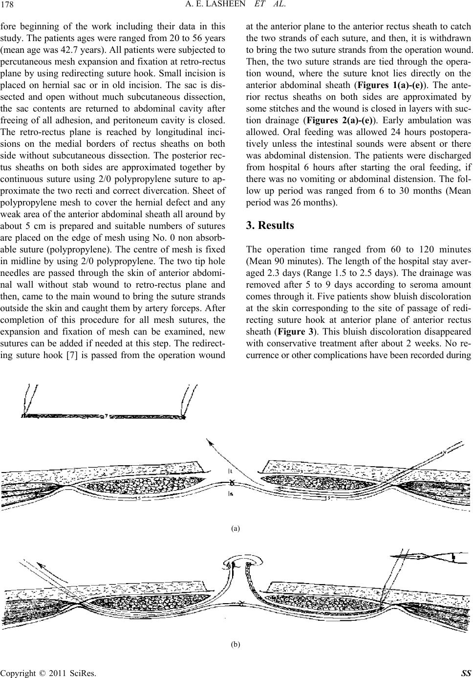 Percutaneous Mesh Expansion and Fixation at the Retro-Rectus Plane without Stabs by Using ...